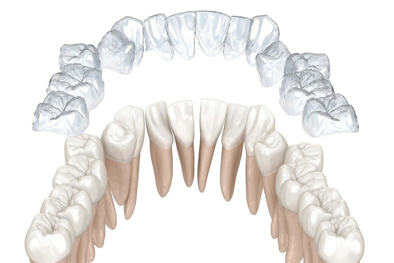 Losing A Tooth And Invisalign: What You Need To Know
